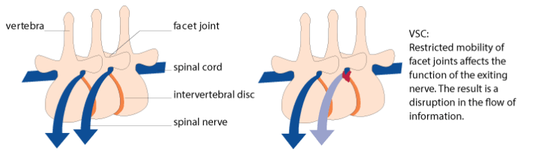 Vertebral Subluxation Complex (VSC) - International Veterinary ...